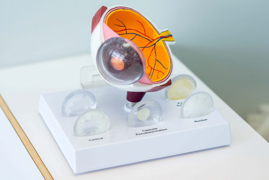 okanagan-vision-therapy-Extraocular-Muscles-model | Okanagan Vision Therapy