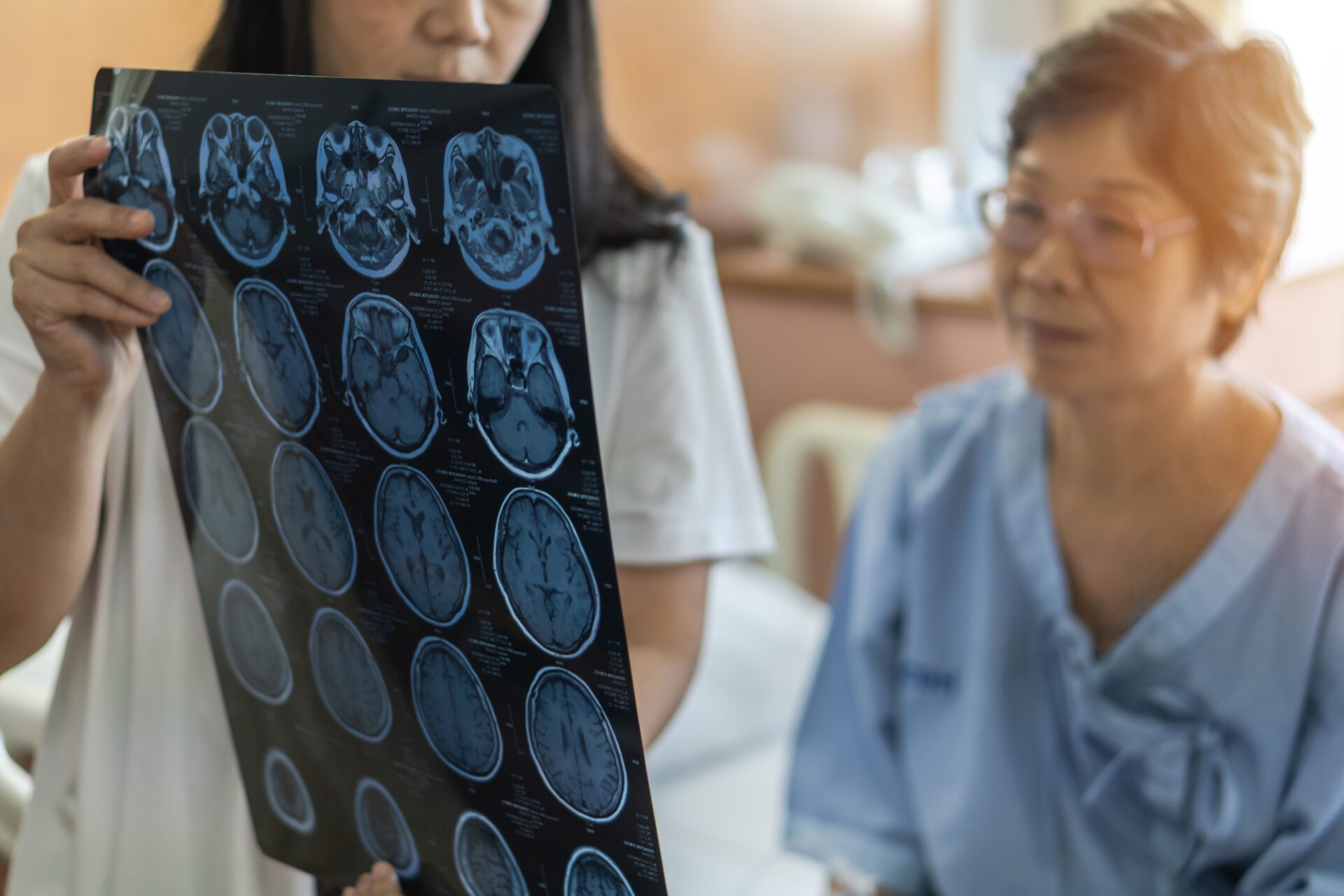 Vision Stroke How Does A Stroke Affect Your Vision Okanagan
